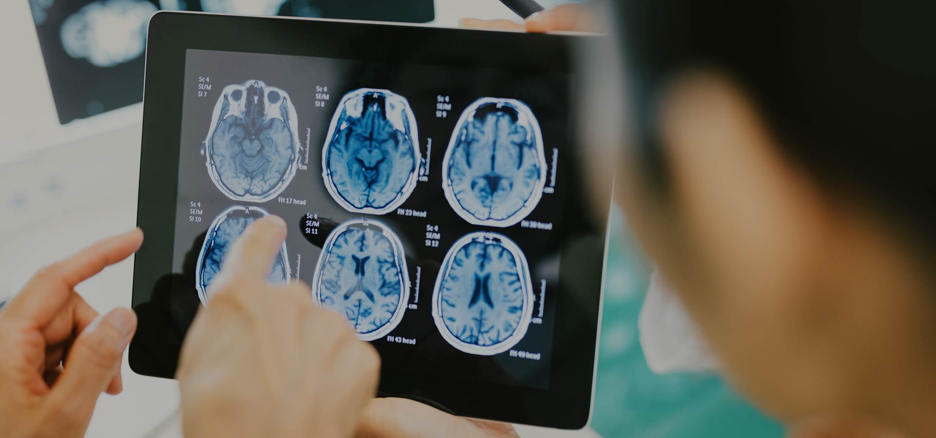 How to Care for Someone with a Traumatic Brain Injury (TBI)